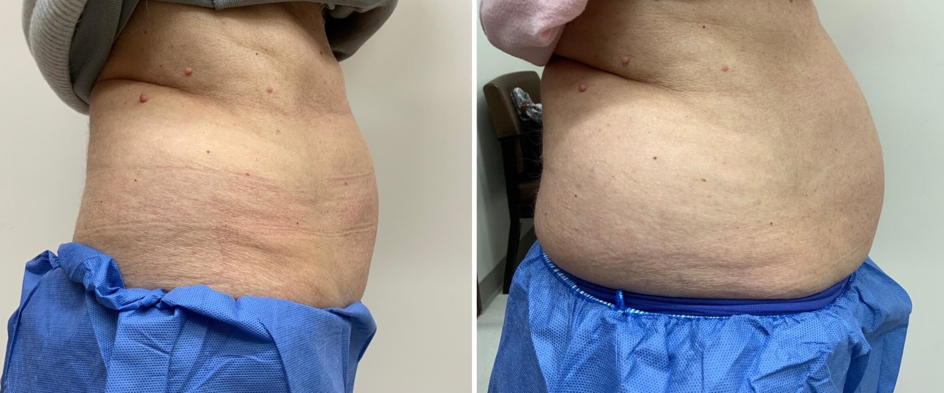 Photos and Videos of Successful Treatments: A Comprehensive Look at ...